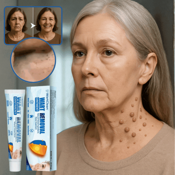 WartClean™ Wart Cream